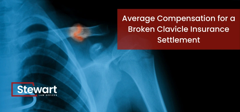Average Compensation for a Broken Clavicle Insurance Settlement